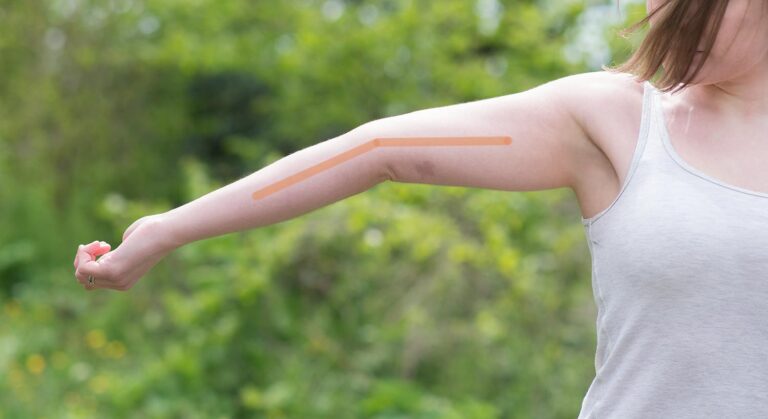 Introduction to joint hypermobility and connective tissue disorders ...